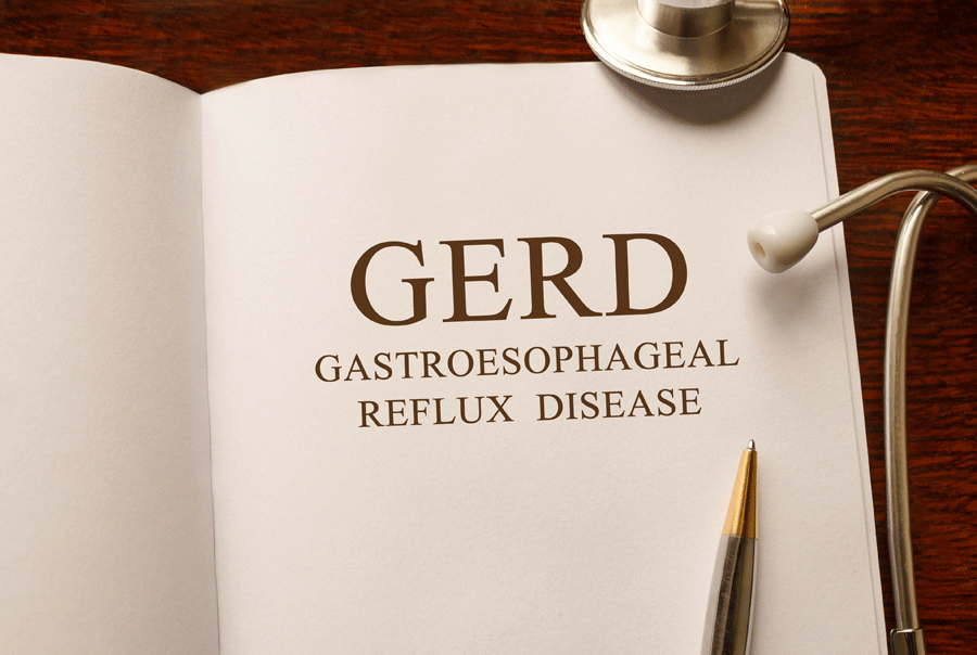 What is GERD | Saint Peter's Physician Associates
